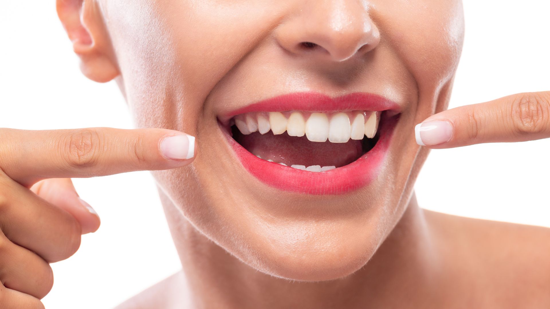 Hàm răng đẹp chuẩn nha khoa gồm các tiêu chí nào? - Phòng khám nha khoa ...