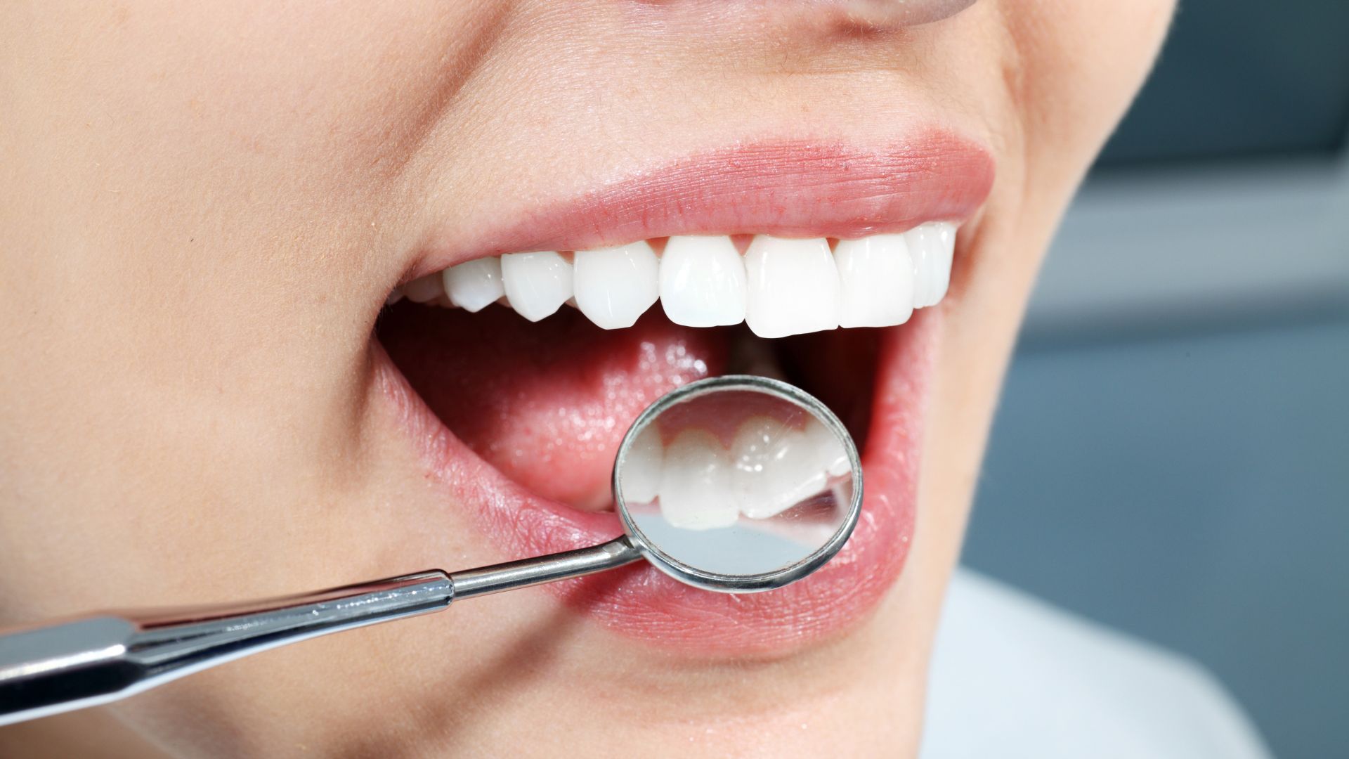 Hàm răng đẹp chuẩn nha khoa gồm các tiêu chí nào? - Phòng khám nha khoa ...